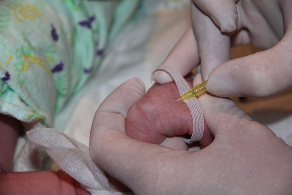 Nghiên cứu trường hợp nhiều lần cố gắng đặt catheter tĩnh mạch ngoại vi ở trẻ sơ sinh – Thư Viện ...